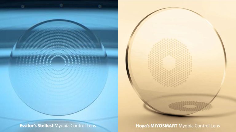 Stellest VS MiYOSMART - Who is better? - Rx optometry